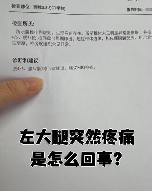 女人左腿疼痛位置图图标