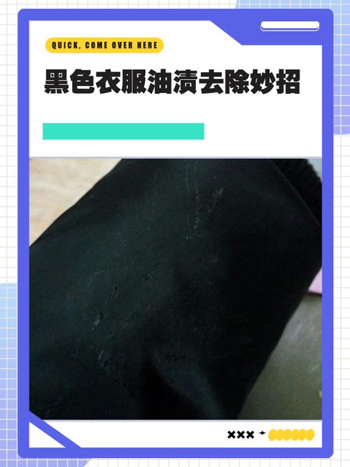 羽绒服上有黑色中性笔印怎么去除图标