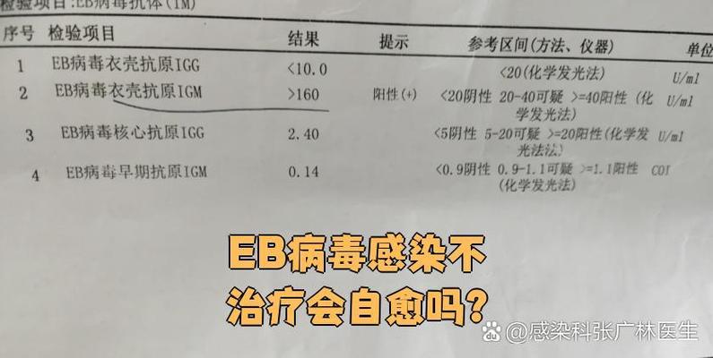 EB病毒会自愈吗图标