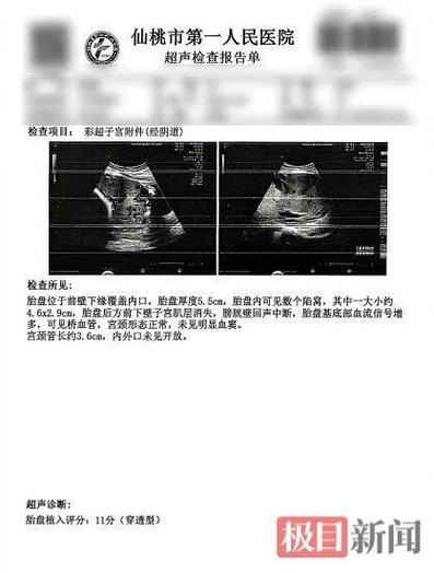 b超和彩超的区别图标