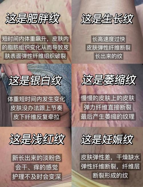 钢化膜彩虹纹多久消失图标