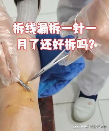 漏了一针怎么补救图标