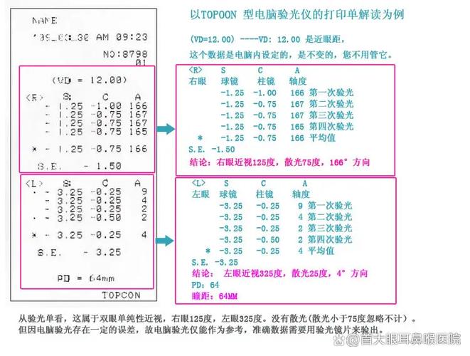 裸眼视力od是什么意思图标