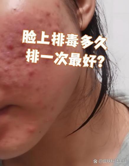 如何排出脸上的毒素图标