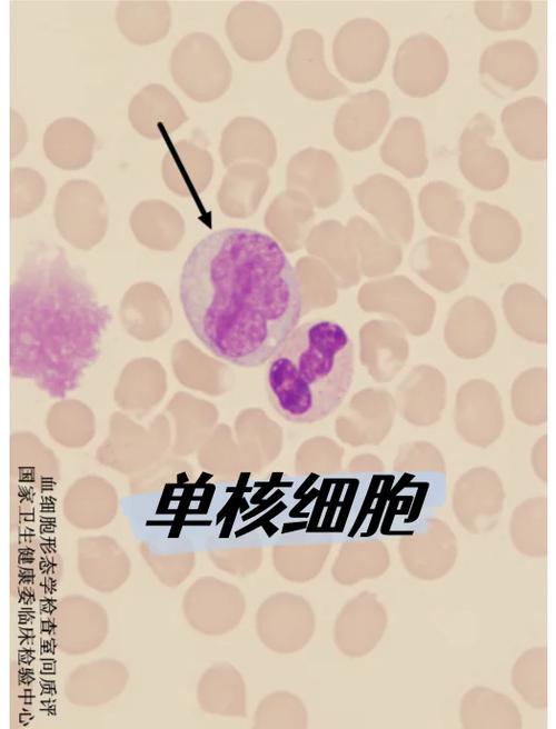 β-catenin核的意义图标