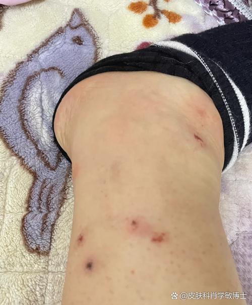 一挠就痒图标