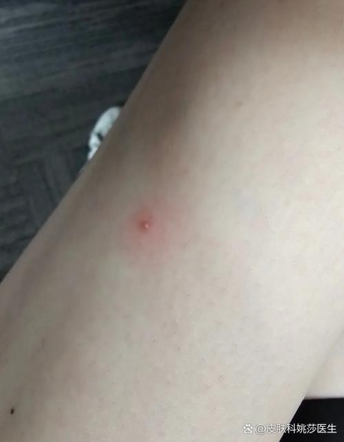 电脑屏幕中间一个红点图标