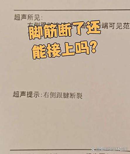 脚断了分离能接上吗图标
