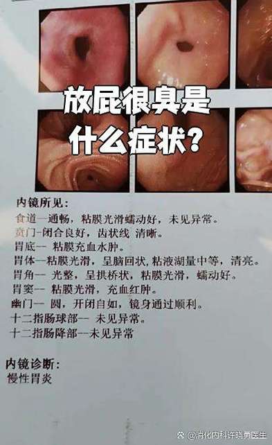 放屁越臭越说明什么图标