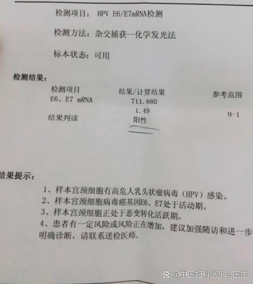 E6E7是查HPV哪几个型号图标