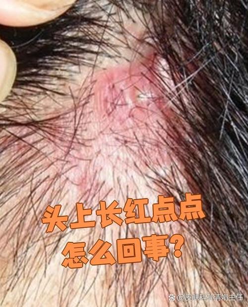 头皮红点点是怎么回事图标