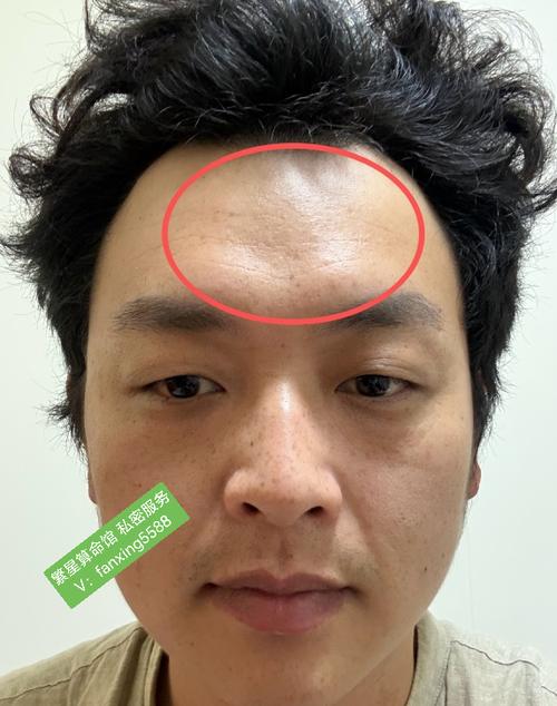 额头有几处凹陷图标