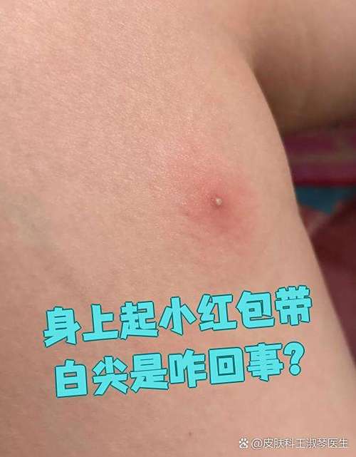 皮肤长红包截图