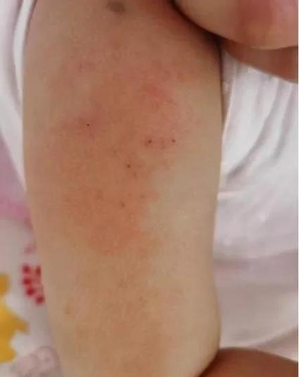 宝宝打完疫苗小豆苗没更新