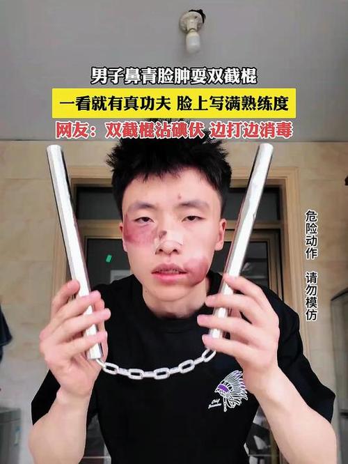 打的鼻青脸肿的特效截图