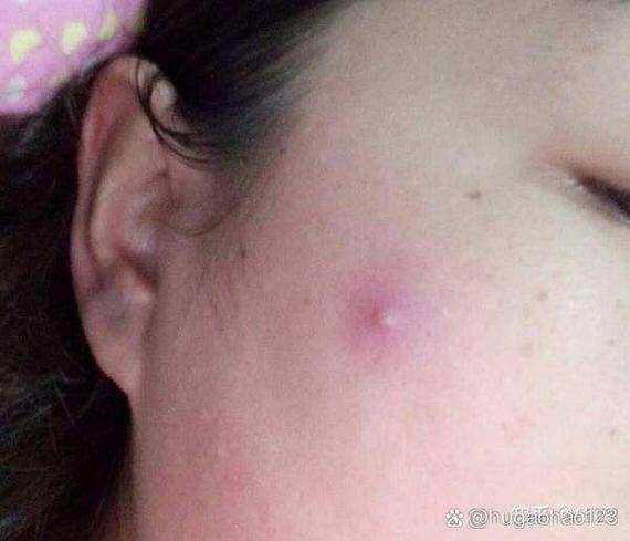 脸上长很多小红包图标
