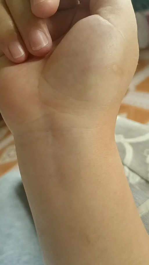 手指像脉搏一样跳着疼图标