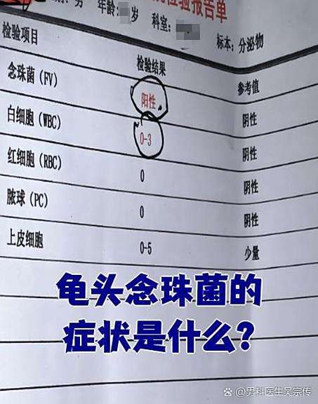 念珠菌是怎么传染上的截图