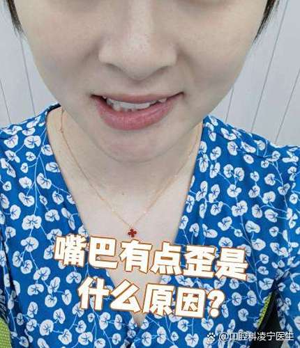 自拍嘴巴是歪的为什么图标
