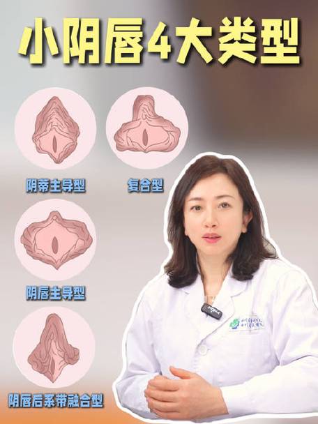 女性私处形状有哪几类型图标