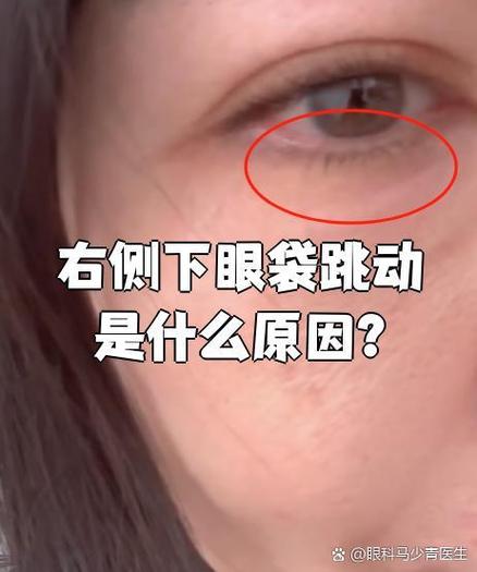 右边脸部眼下肌肉一直在跳动