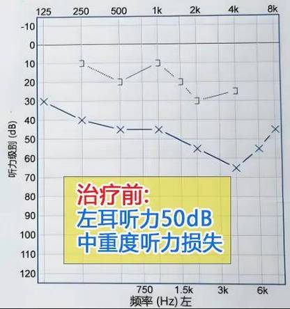 耳朵里面有晃动的声音是怎么回事图标