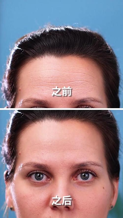 男人抬头纹去除简单的截图