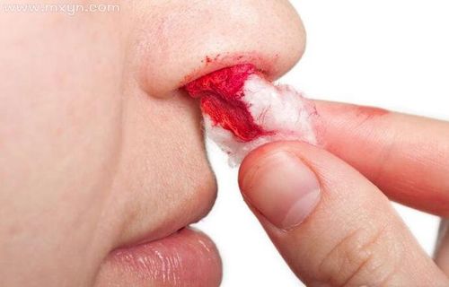 流鼻血是发财征兆吗截图