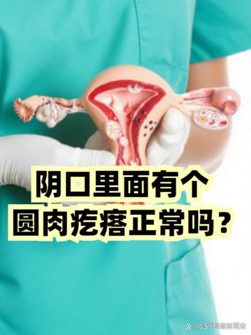 阴口里有坨肉,那是什么圆圆的东西截图