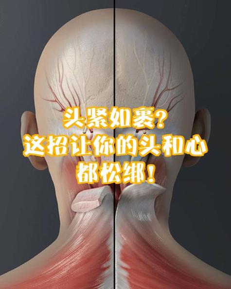 焦虑症头部紧绷感怎么解除图标