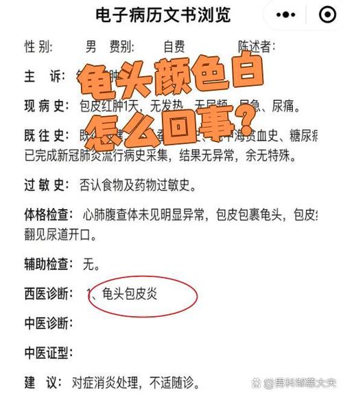 男性龟的头上发白是什么原因图标