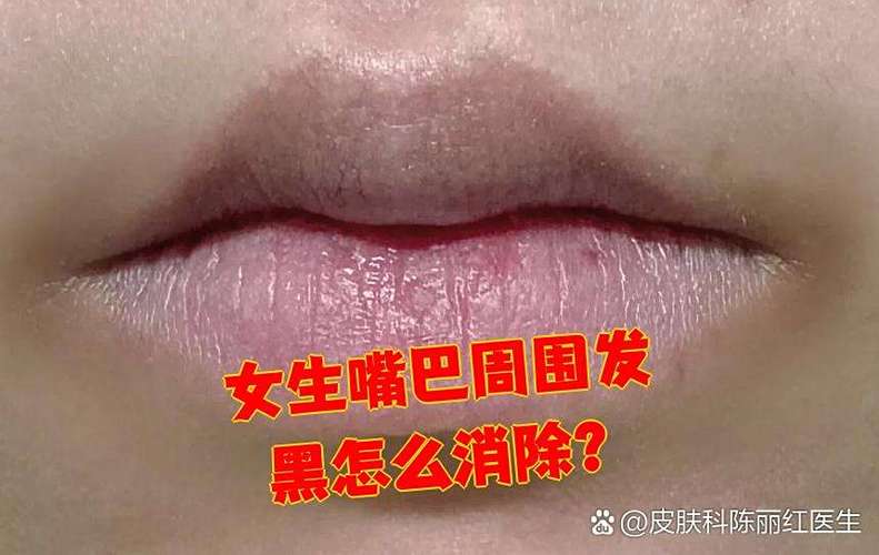 女生回复emm黑嘴是什么意思图标
