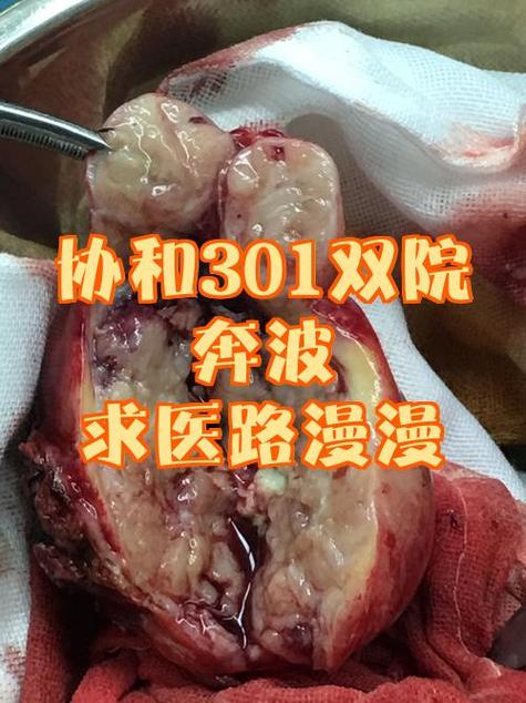 301跟协和的差距图标