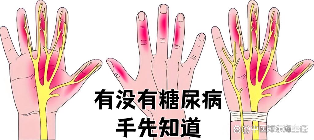 糖尿病刚开始是什么状态了游戏截图