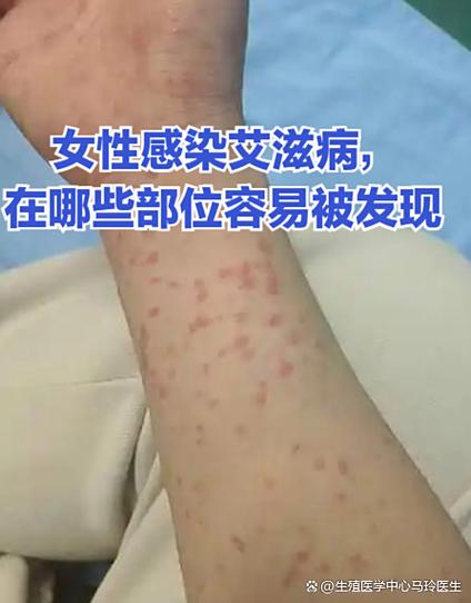 艾滋病病毒属于细菌病毒吗图标