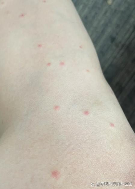 皮肤过敏起红点点图标