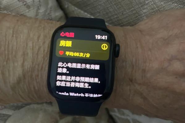 手表偶尔提示房颤正常吗