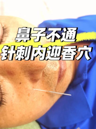 中医鼻炎怎么治效果最好方法截图