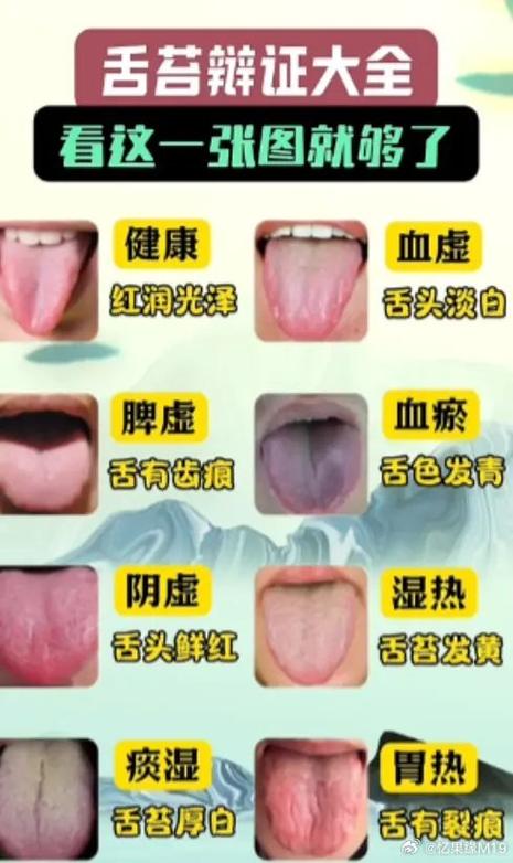 舌头上的鹅口疮图片图标