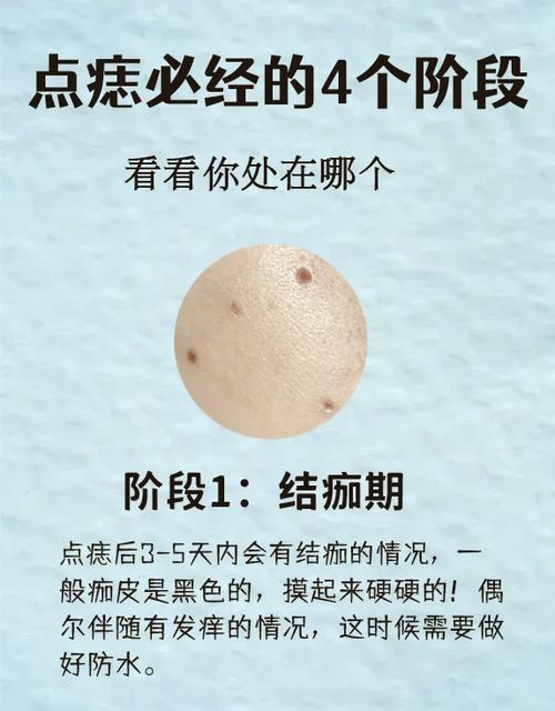 皮肤无故结痂的诱发因素图标