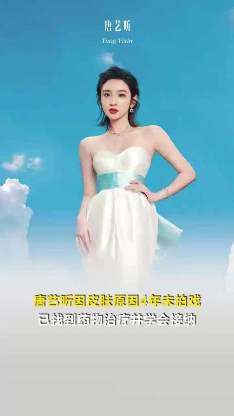 唐艺昕因皮肤原因4年未拍戏截图