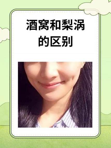 米涡与梨涡的区别截图