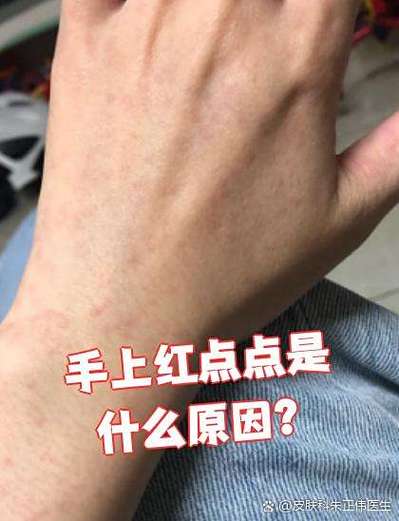 前摄像头旁边的红点一直闪图标