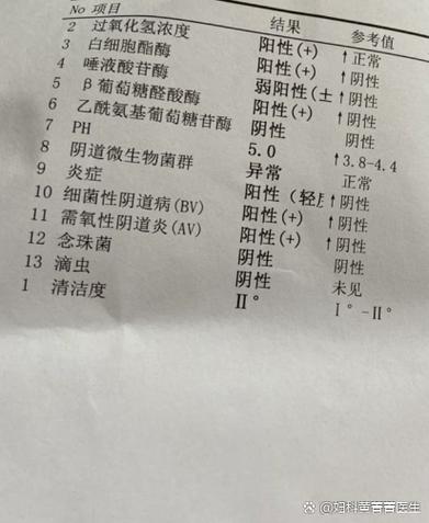 白带像脓涕一样是什么原因截图
