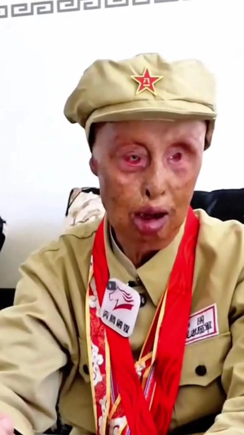 英雄联盟最肉的英雄图标