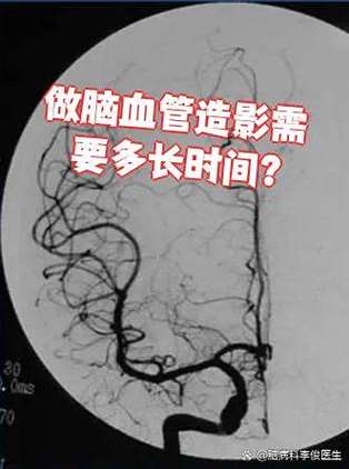 造影后一般寿命多长截图