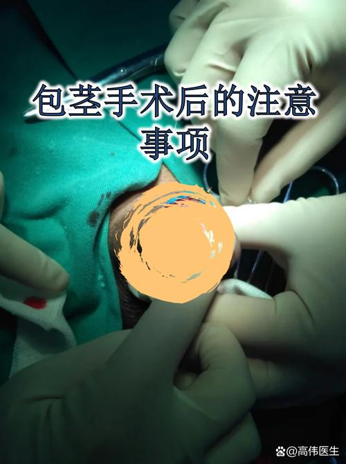 安装包失效可以恢复吗?图标
