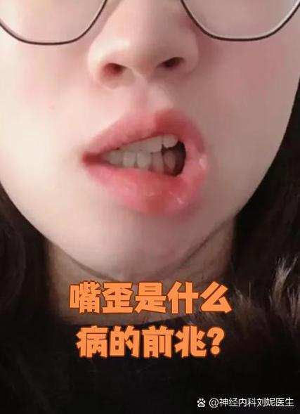 下嘴唇抽搐是中风吗图标