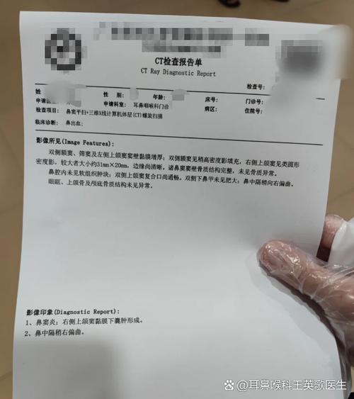 总是流鼻血是什么原因图标