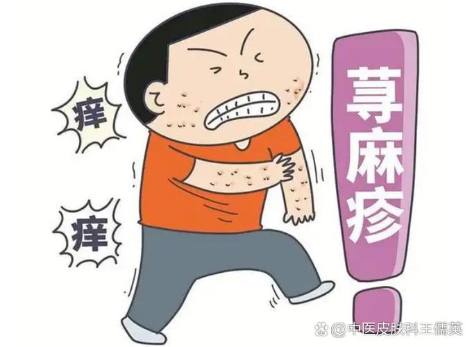 突然身上到处痒一挠就起疙瘩图标